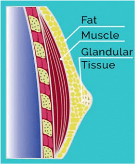 Gynecomastia Info, Treatment, Support, Forum | Gynecomastia.org